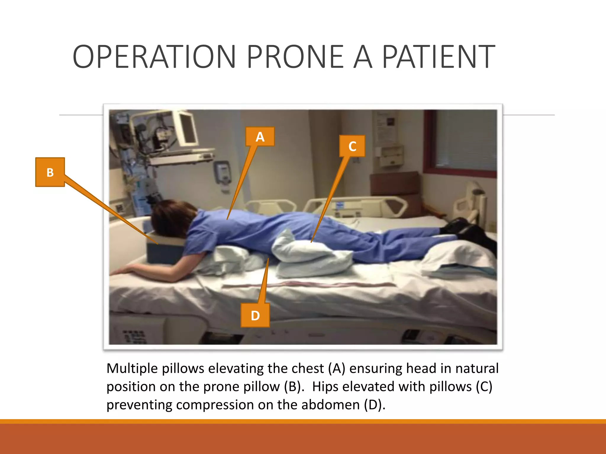 CACCN Conference: ARDS & Prone Position | PPTX | Lung and Respiratory Health | Diseases and ...
