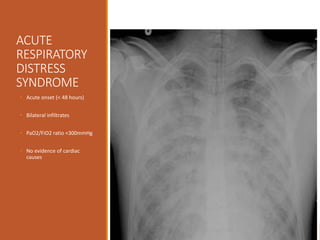CACCN Conference: ARDS & Prone Position | PPTX