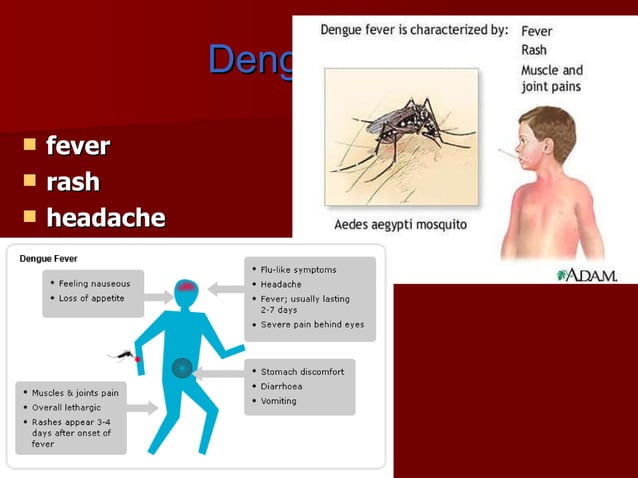 dengue | PPT | Infectious Diseases | Diseases and Conditions