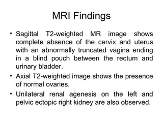 Mayer rokitansky-küster-hauser syndrome | PPT