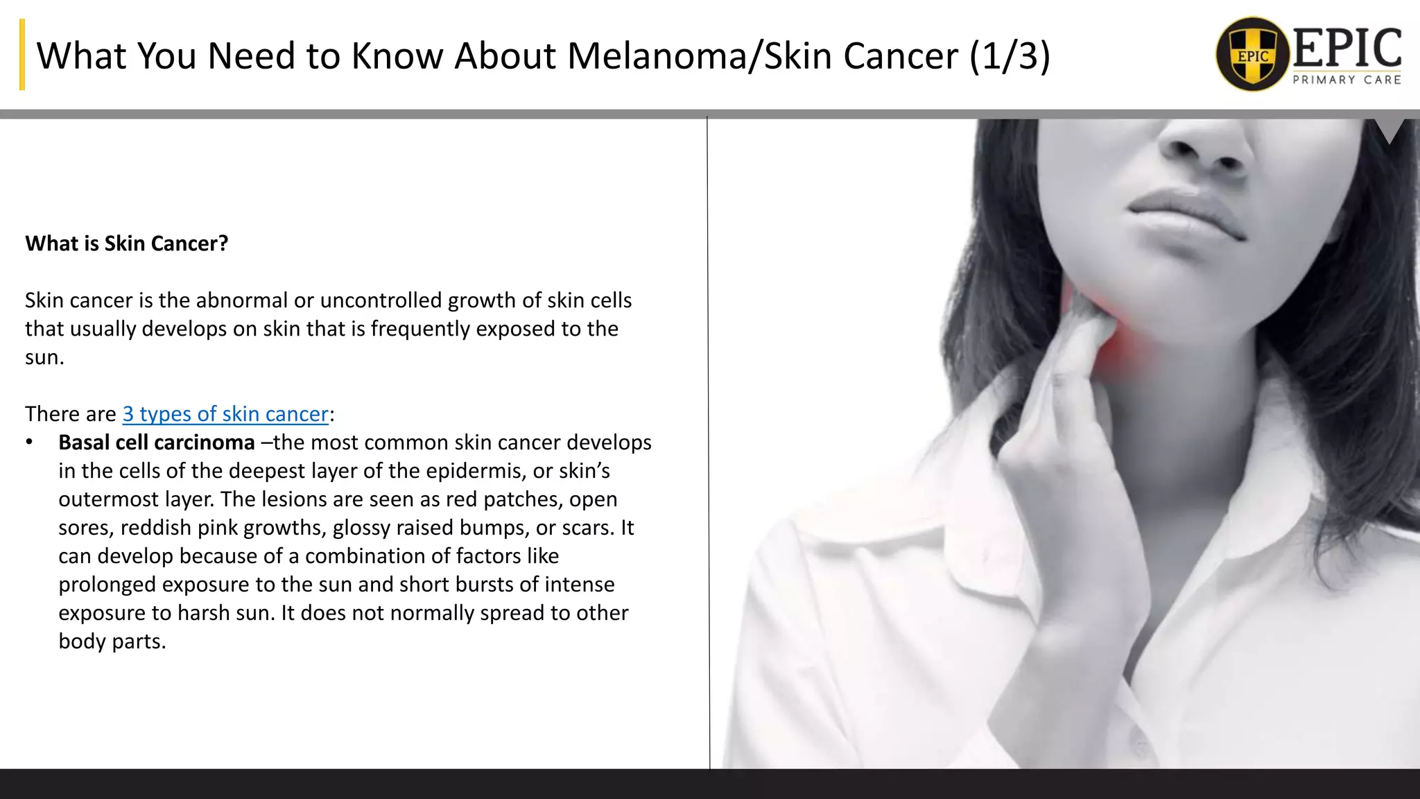 All You Need to Know About Melanoma/Skin Cancer | PPTX