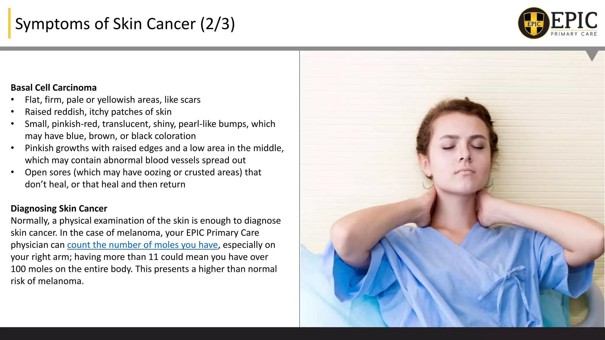 All You Need to Know About Melanoma/Skin Cancer | PPTX