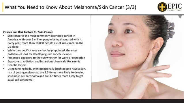 All You Need To Know About Melanomaskin Cancer Ppt 2505