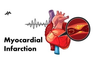 mayocardial infraction heart disease.pptx