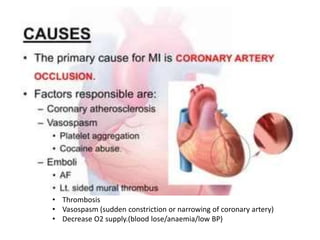 mayocardial infraction heart disease.pptx