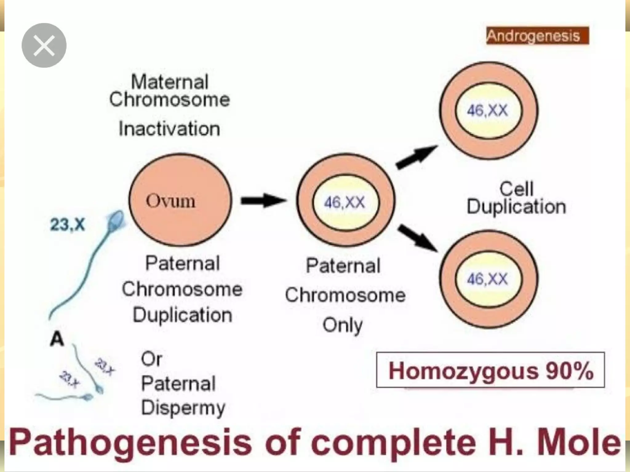 hydatidiform mole | PPT