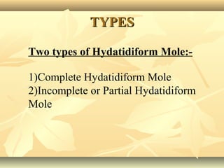 hydatidiform mole | PPT