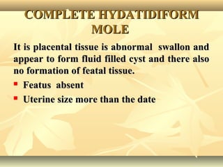 hydatidiform mole | PPT