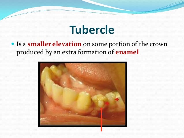 Mazen doumani dental anatomy