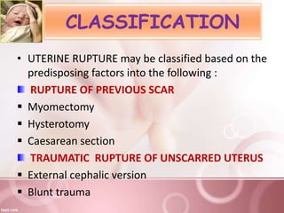 A Study On Rupture uterus In Women with Previous Caesarean Sections | PPT