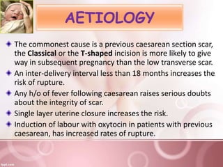 A Study On Rupture uterus In Women with Previous Caesarean Sections | PPT