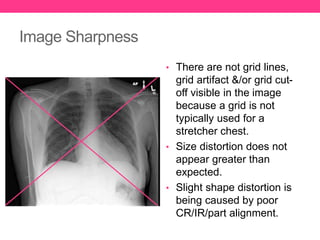 Image Evaluation: Stretcher Chest | PPTX