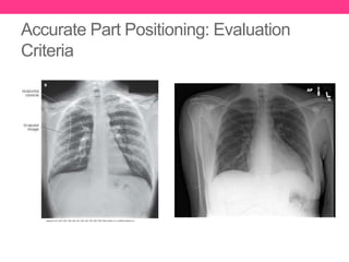 Image Evaluation: Stretcher Chest | PPTX