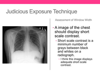 Image Evaluation: Stretcher Chest | PPTX