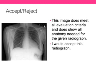 Image Evaluation: Stretcher Chest | PPTX