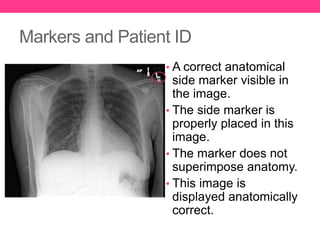 Image Evaluation: Stretcher Chest | PPTX