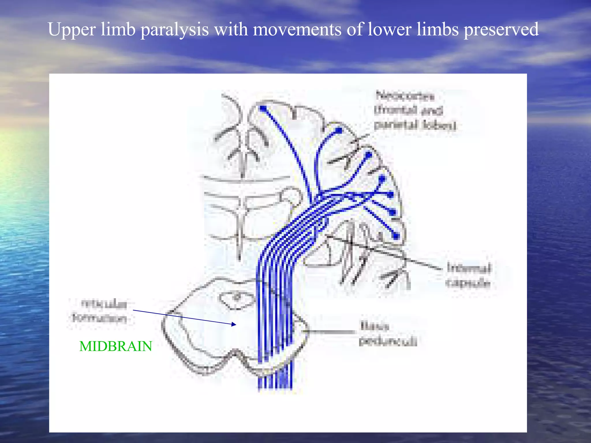 Frontal syndrome and mid-brain lesion | PPT