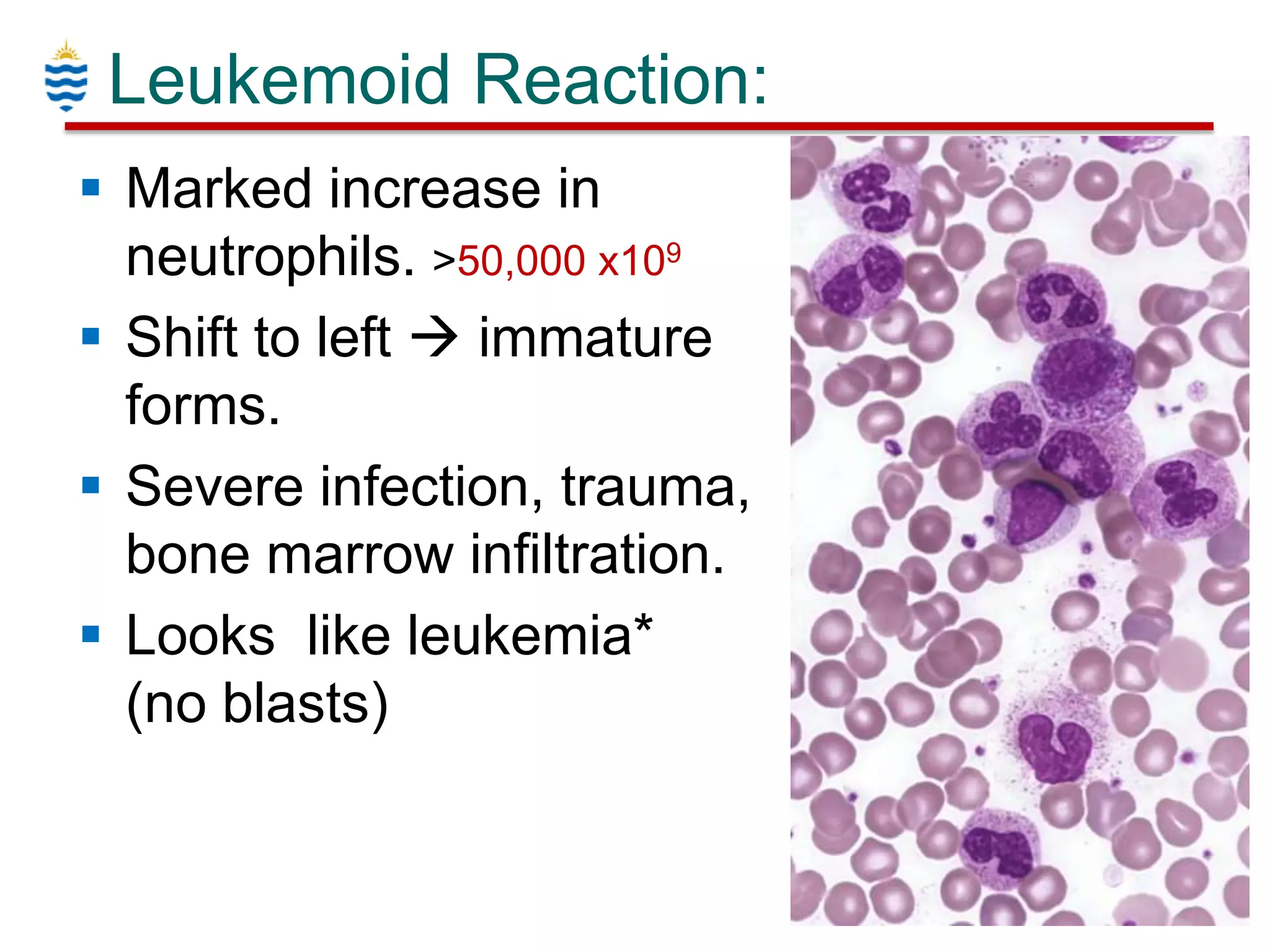 Pathology of WBC Disorders | PPTX