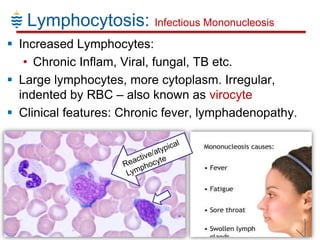 Pathology of WBC Disorders | PPTX
