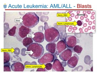 Pathology of WBC Disorders | PPTX