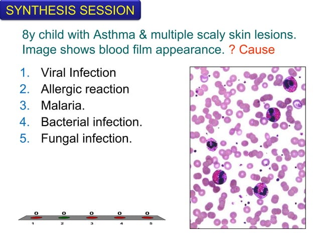 Pathology of WBC Disorders | PPTX | Blood Disorders | Diseases and ...