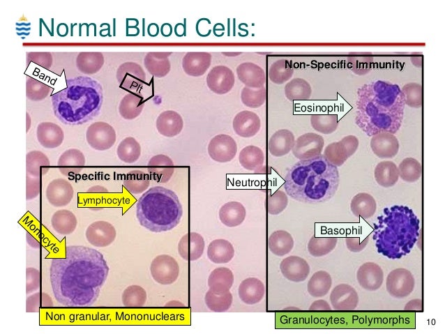 Pathology of WBC Disorders