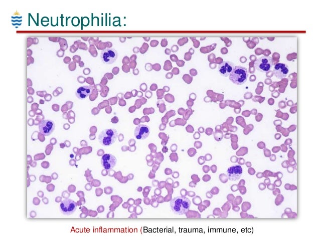 Pathology of WBC Disorders