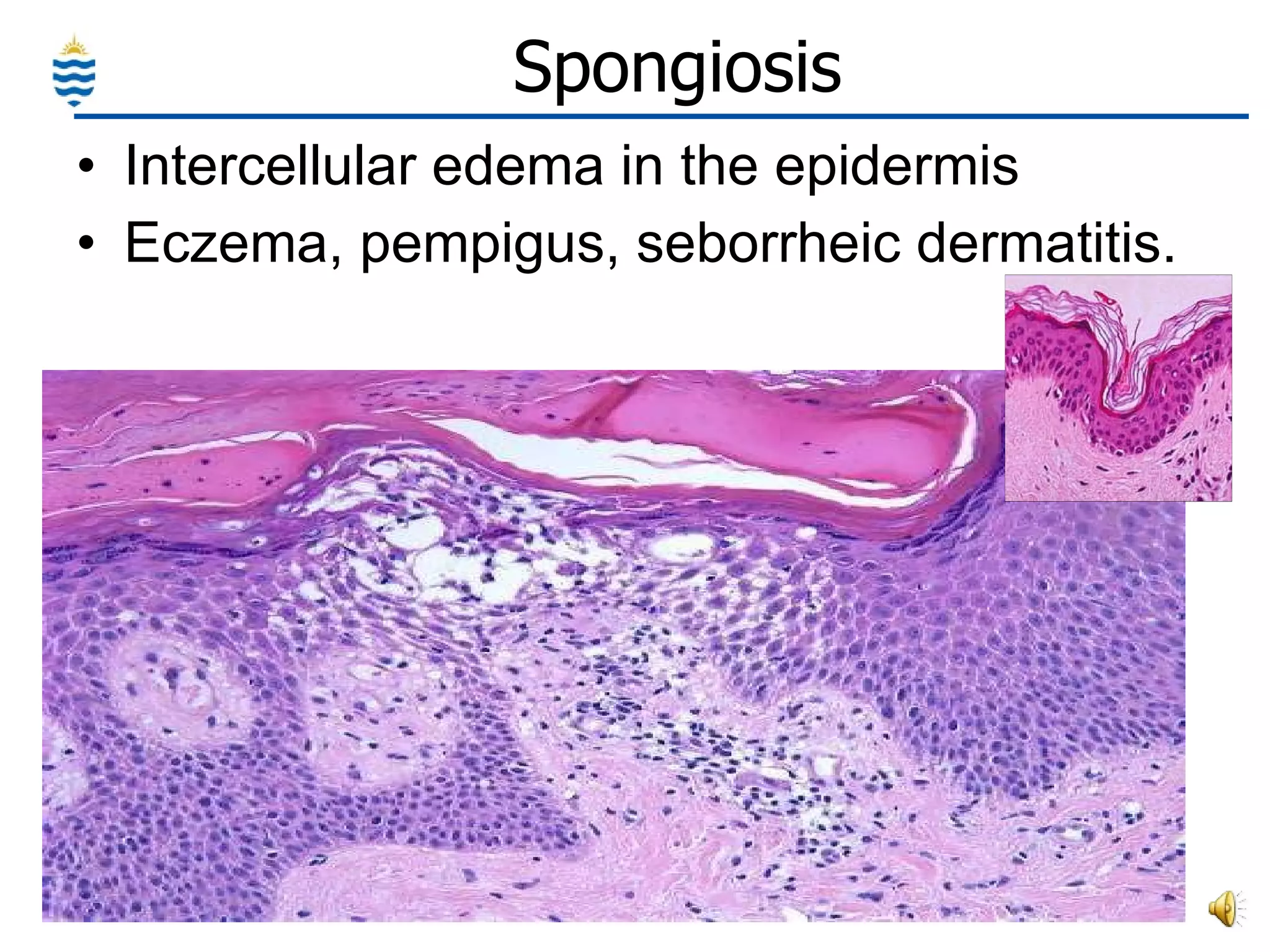 Pathology of Skin - Introduction | PPT