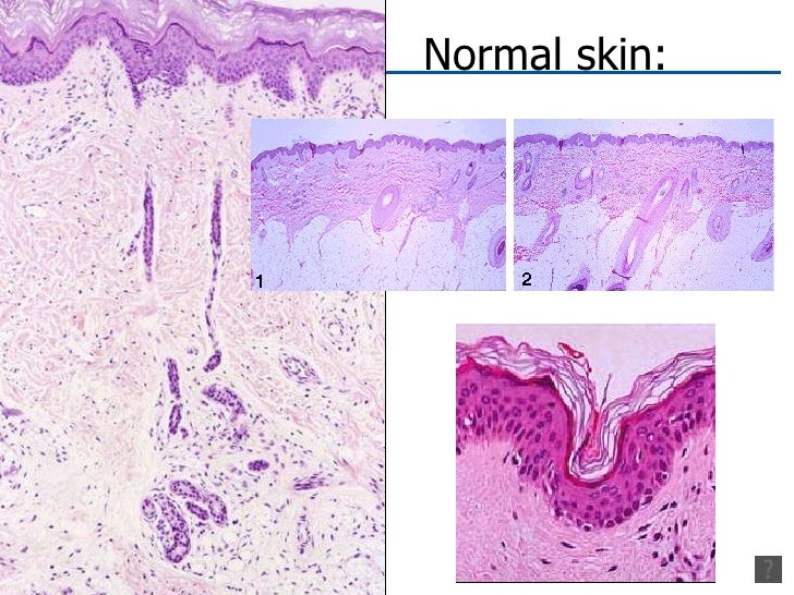 Pathology of Skin - Introduction