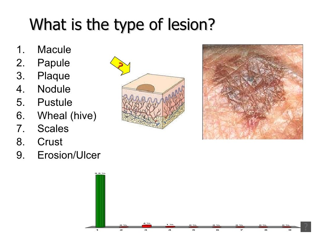 Pathology of Skin - Introduction