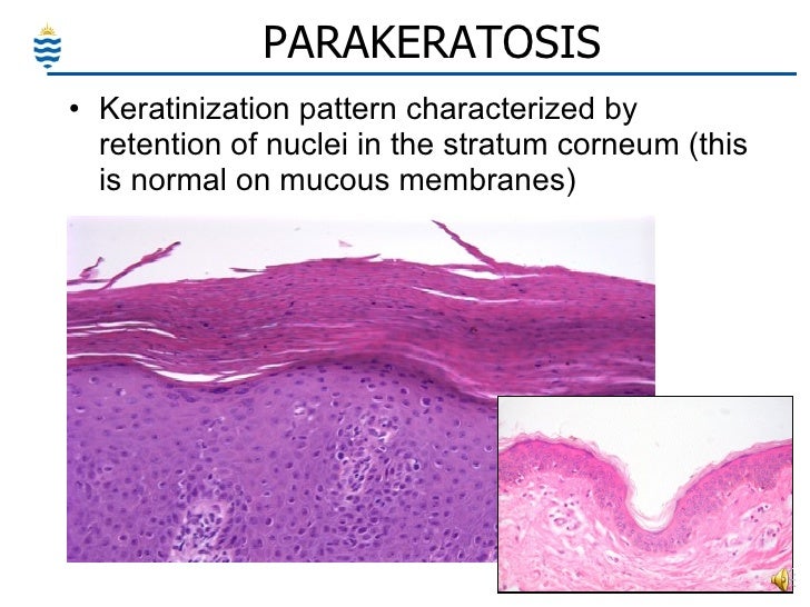Pathology of Skin - Introduction