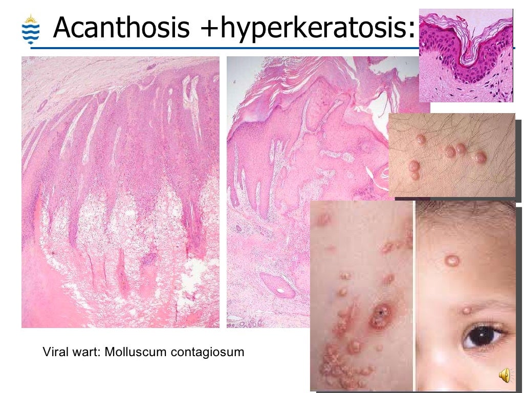 Pathology of Skin - Introduction