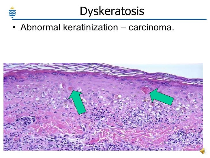 Pathology of Skin - Introduction