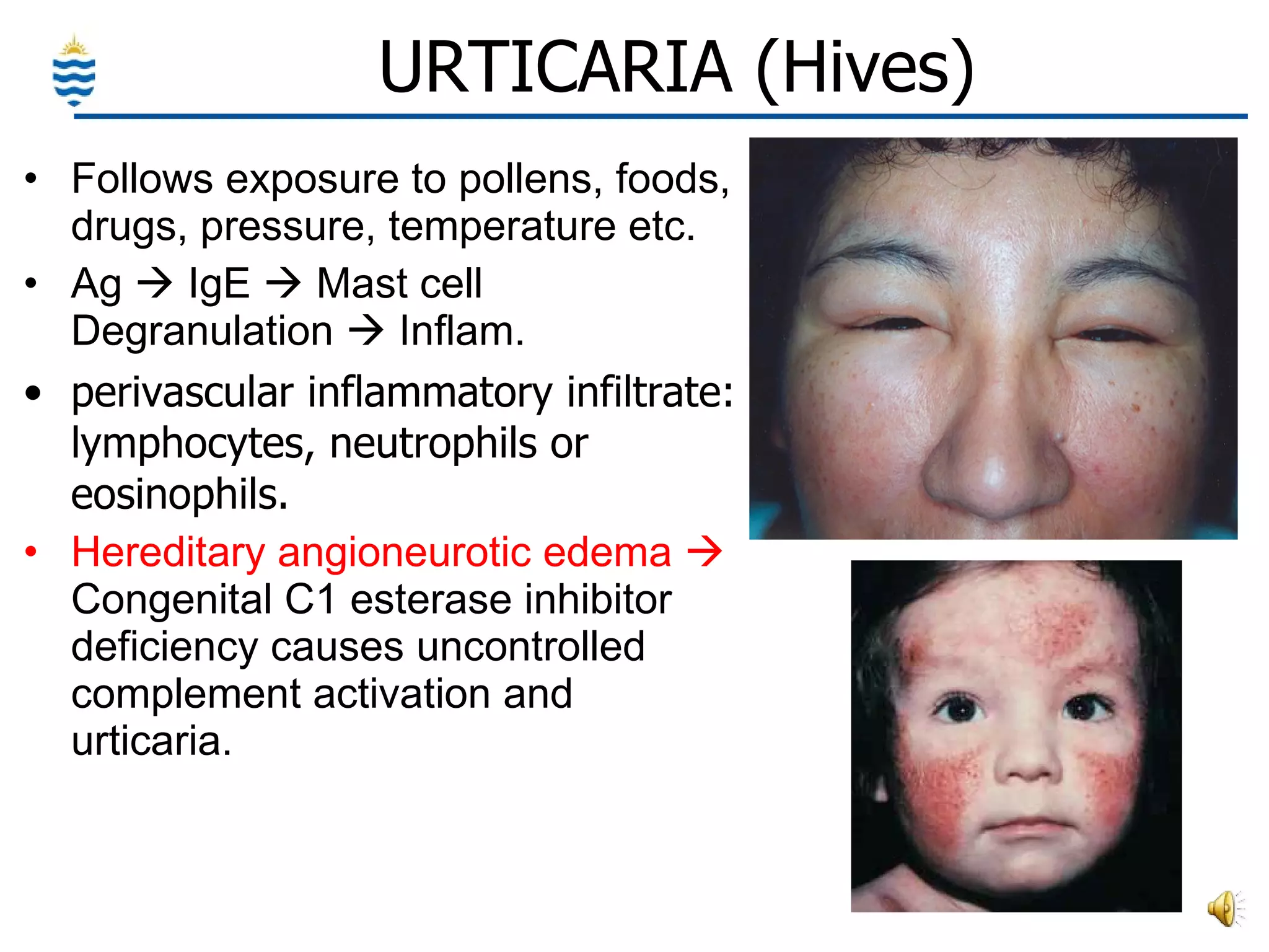 Pathology of Skin - Common Disorders | PPT