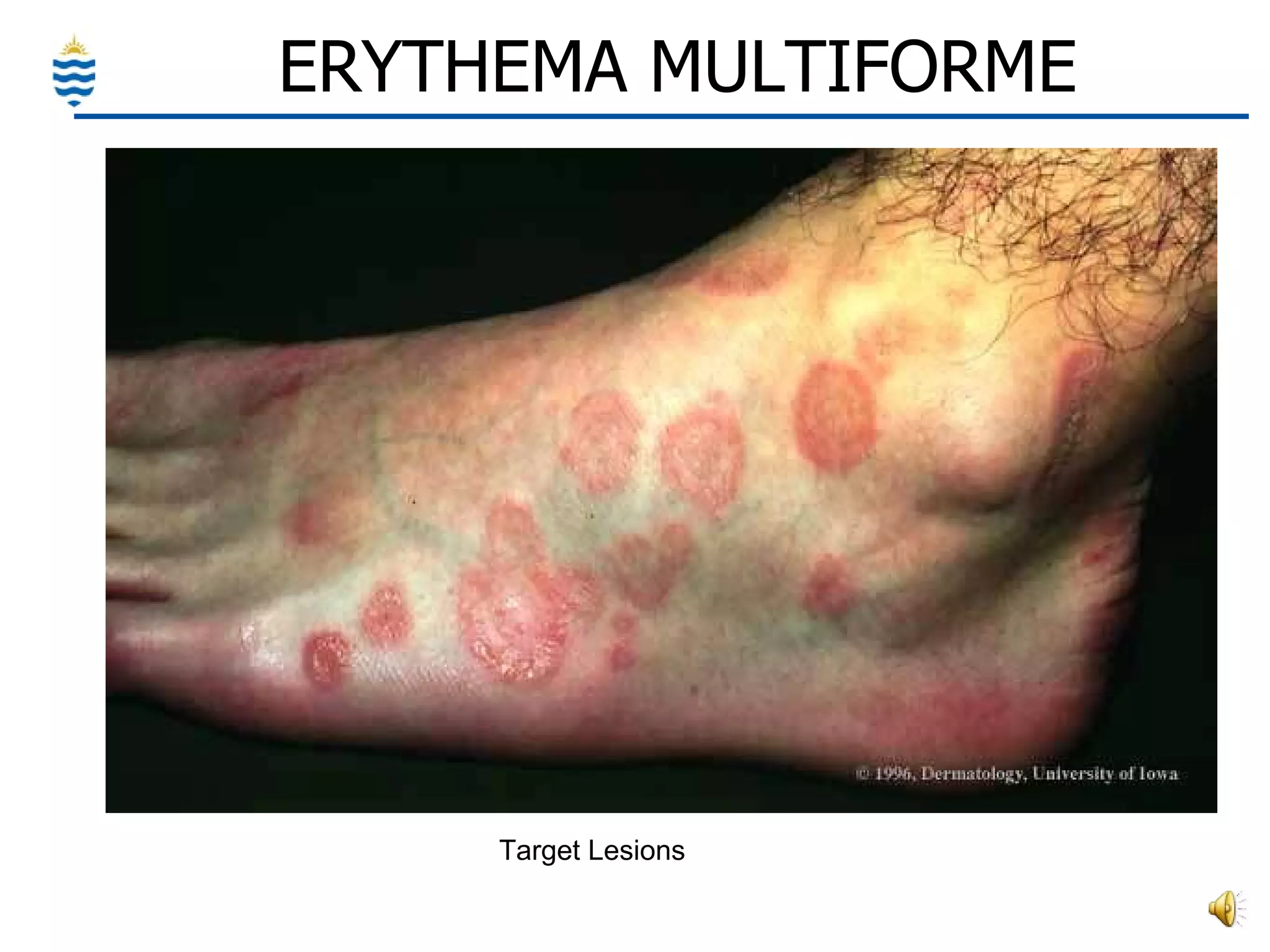 Pathology of Skin - Common Disorders | PPT