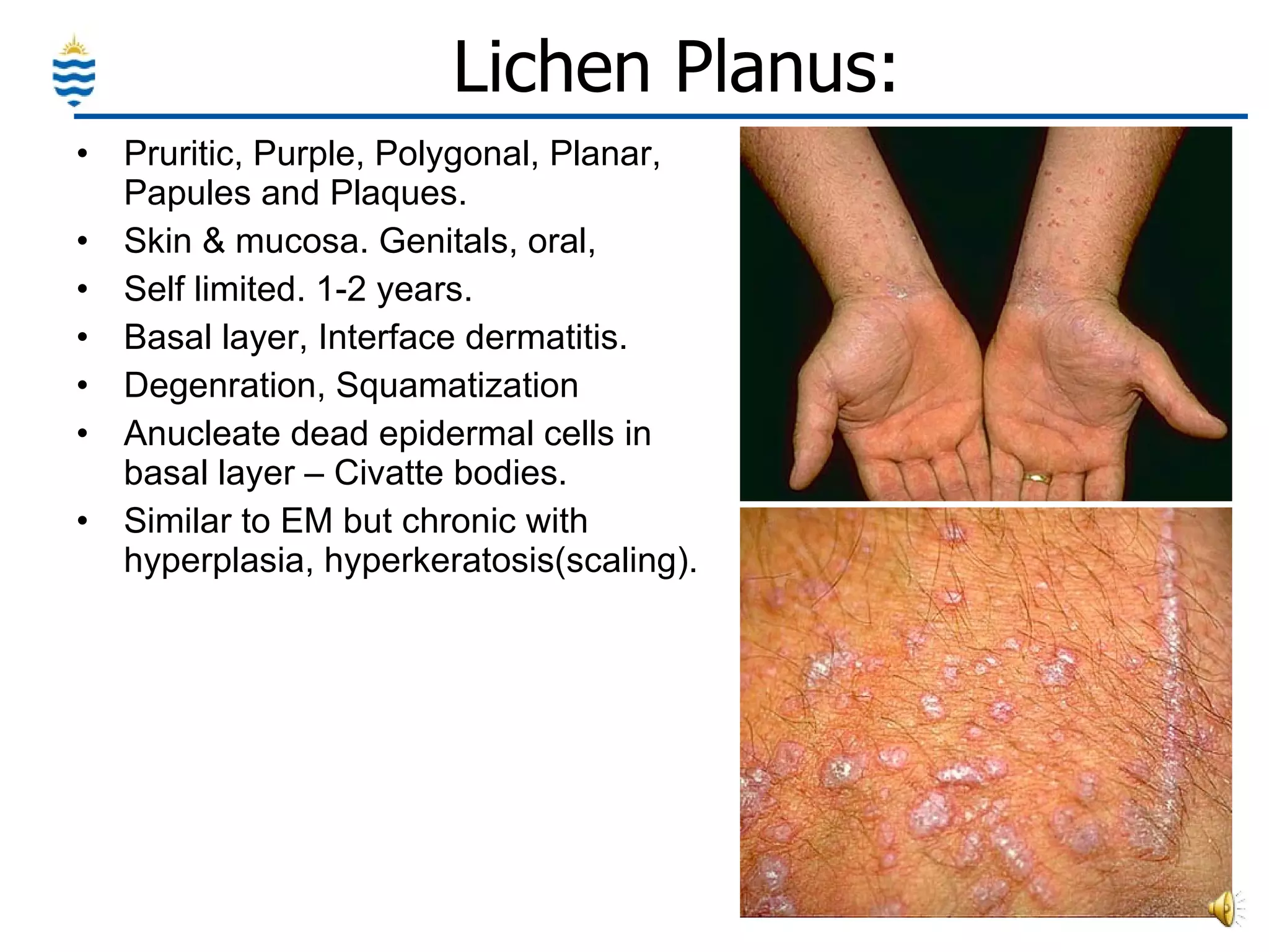 Pathology of Skin - Common Disorders | PPT