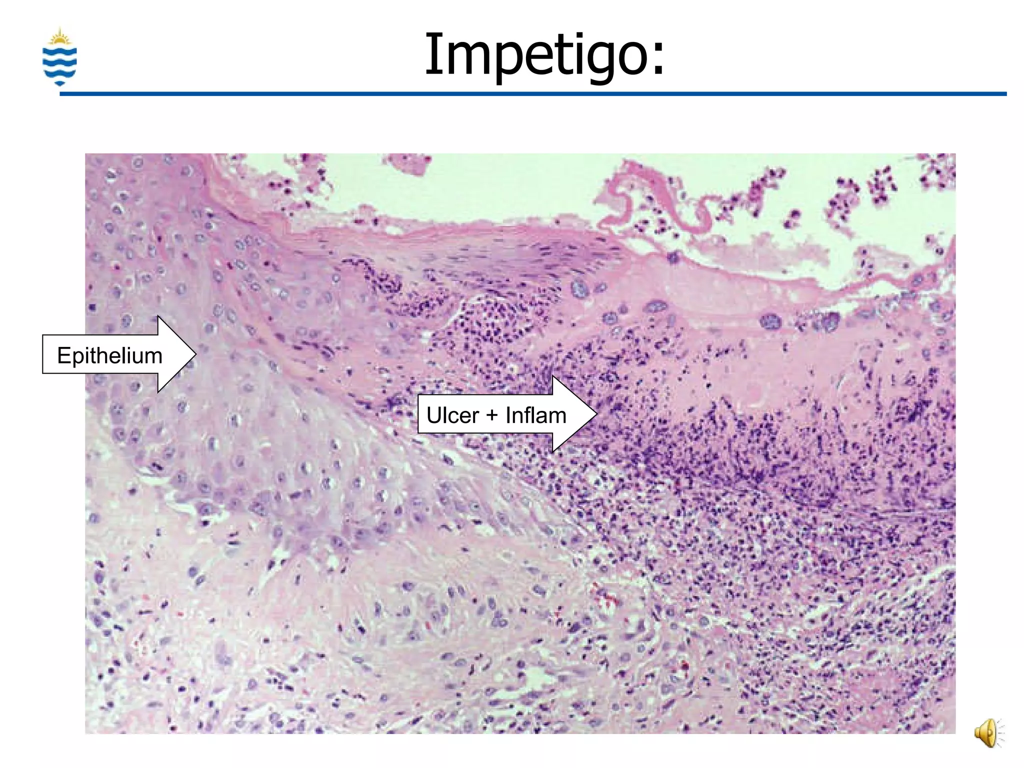 Pathology of Skin - Common Disorders | PPT