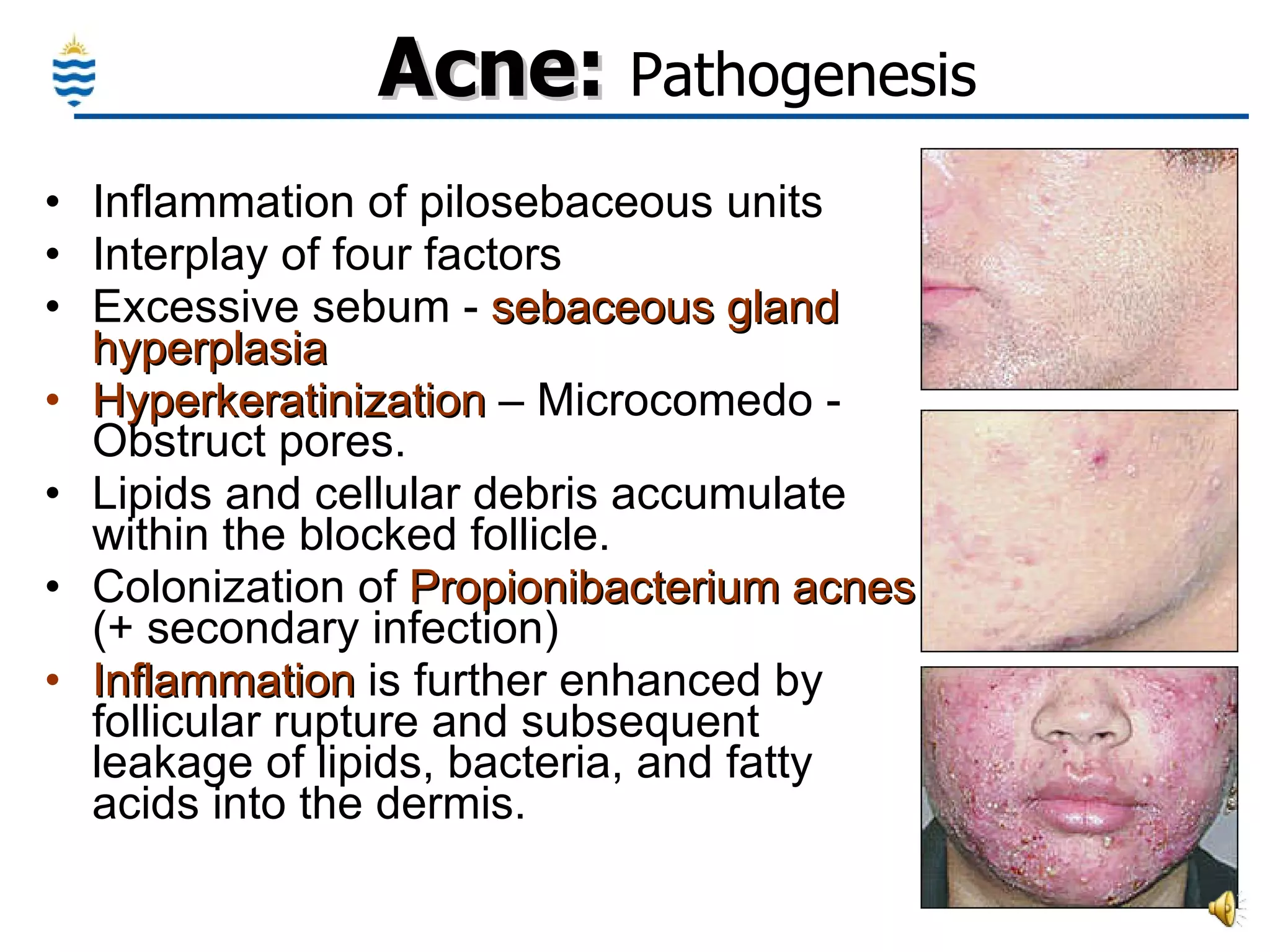 Pathology of Skin - Common Disorders | PPT