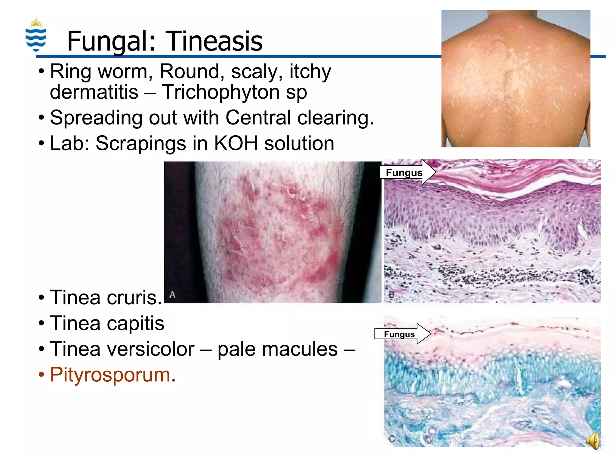 Pathology of Skin - Common Disorders | PPT