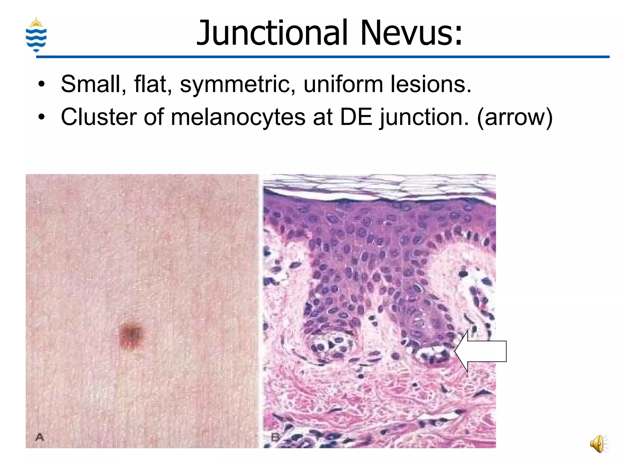 Pathology of Skin - Common Disorders | PPT