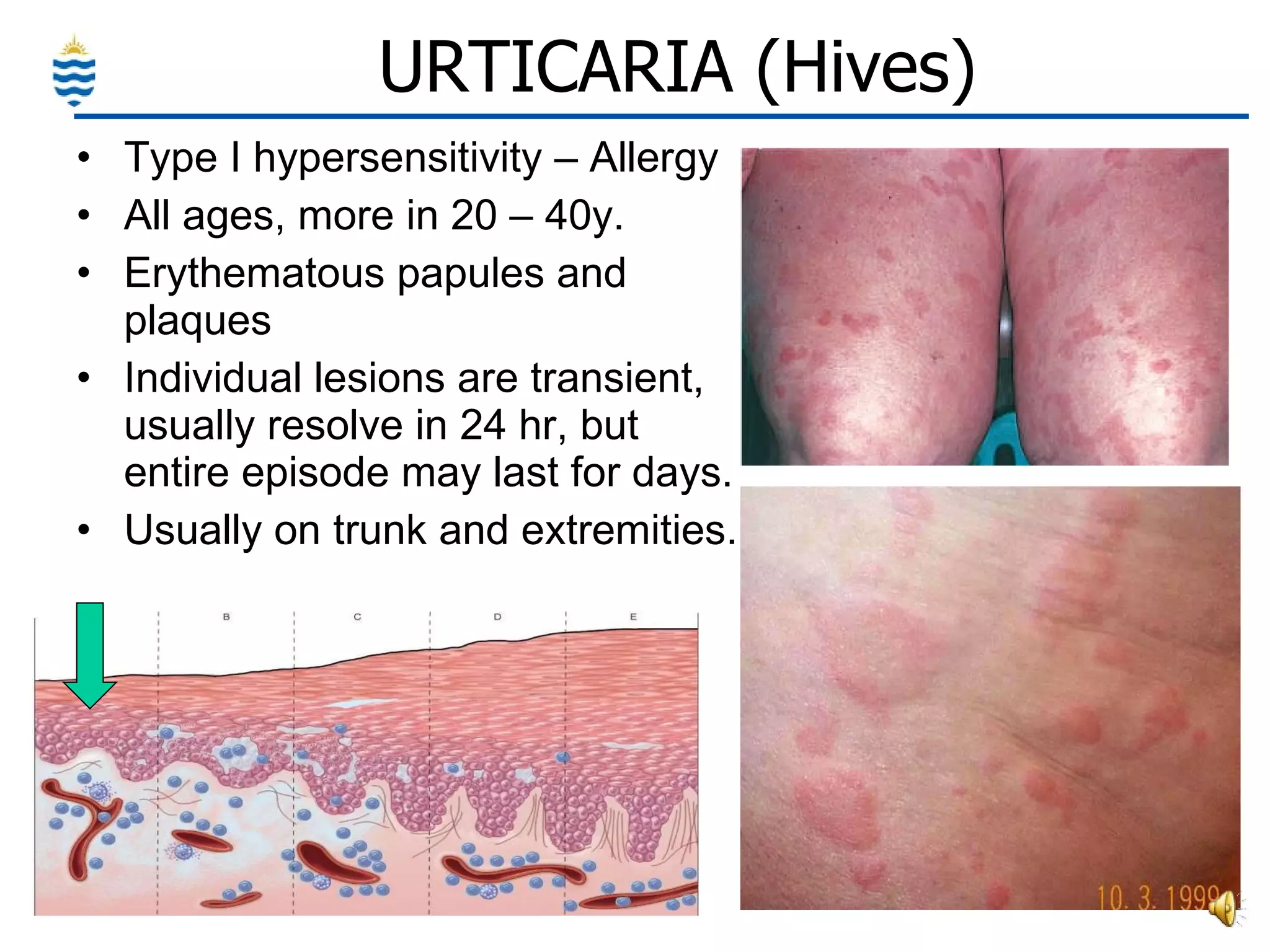 Pathology of Skin - Common Disorders | PPT