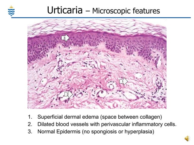 Pathology of Skin - Common Disorders | PPT