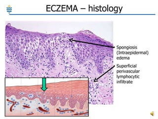 Pathology of Skin - Common Disorders | PPT
