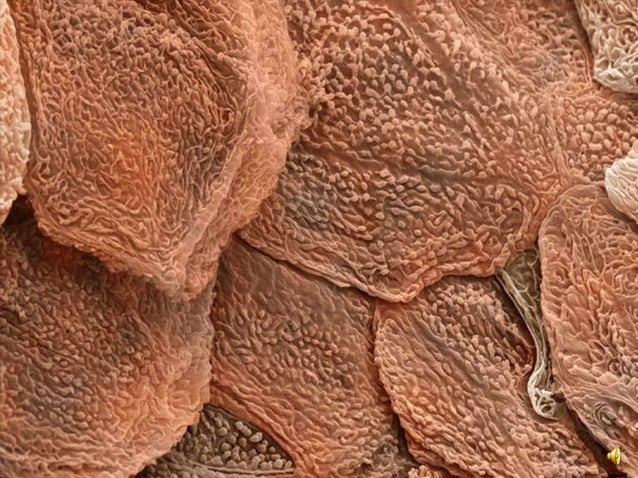 Pathology of Skin - Common Disorders | PPT