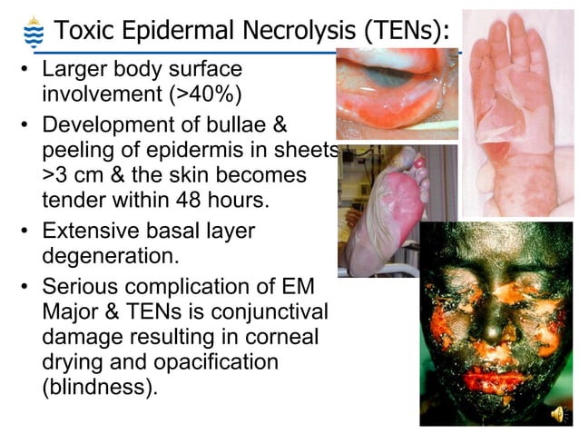 Pathology of Skin - Common Disorders | PPT