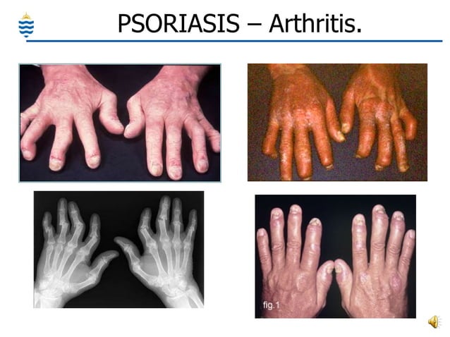 Pathology of Skin - Common Disorders | PPT