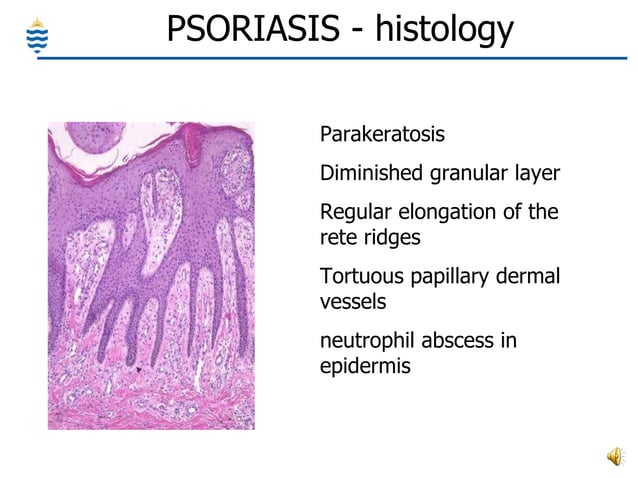 Pathology of Skin - Common Disorders | PPT
