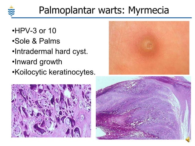 Pathology of Skin - Common Disorders | PPT