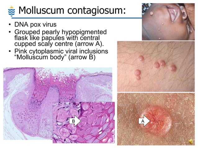 Pathology of Skin - Common Disorders | PPT