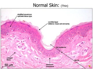 Pathology of Skin - Common Disorders | PPT